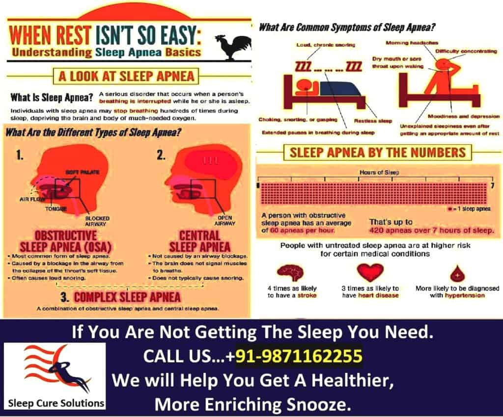 Sleep Apnea – Understanding the Basics - Sleep Cure Solutions